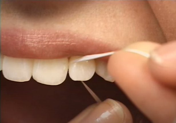 Flossing 101 - Space City Smiles located in Spring Branch
